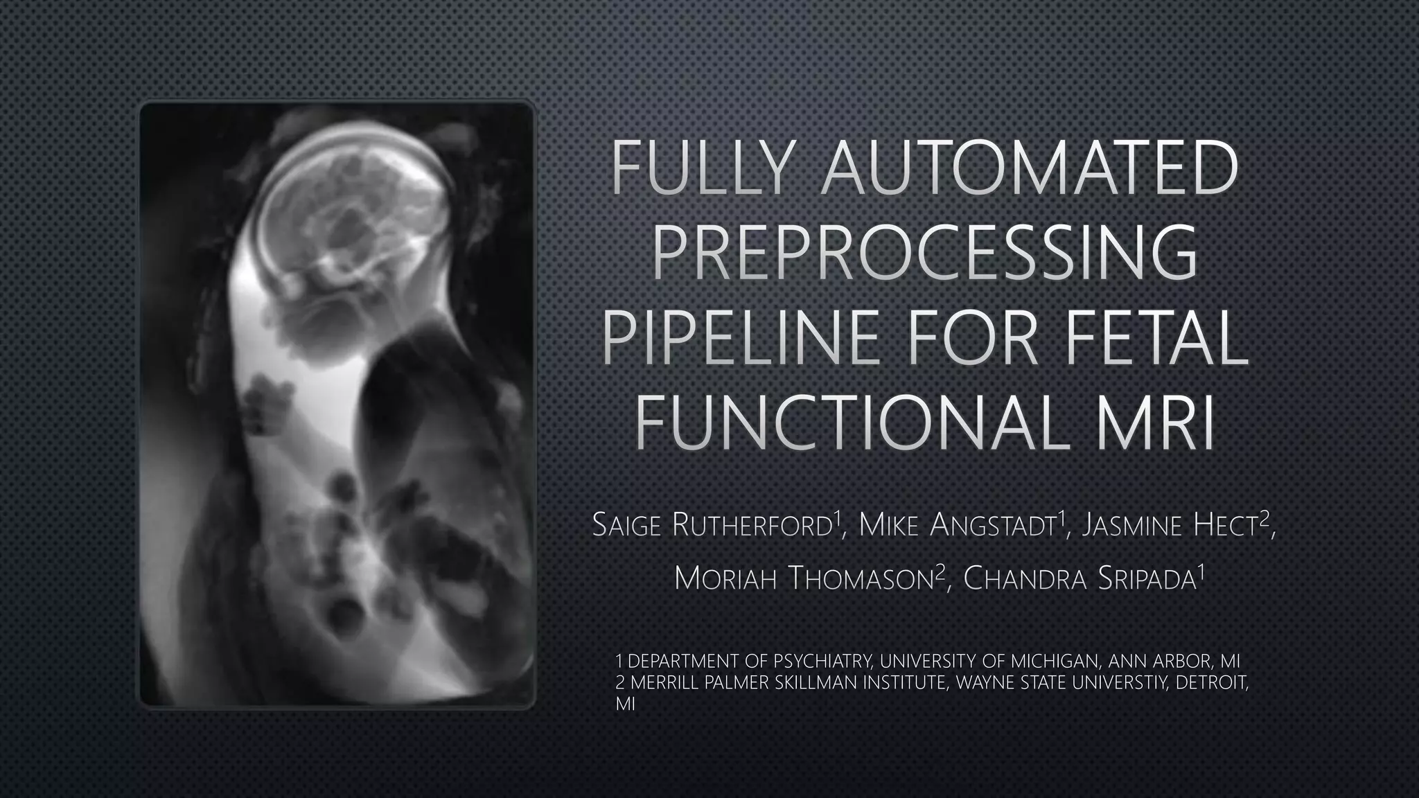 Ismrm 2018 e-poster | PPT