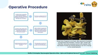 ISMT - Day 381 - Manefo - Posterior Lumbar Interbody Fusion.pptx
