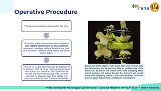 ISMT - Day 381 - Manefo - Posterior Lumbar Interbody Fusion.pptx