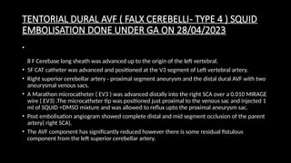 CEREBELLAR ARTERIOVENOUS MALFORMATION ENDOVASCULAR TREATMENT | PPT