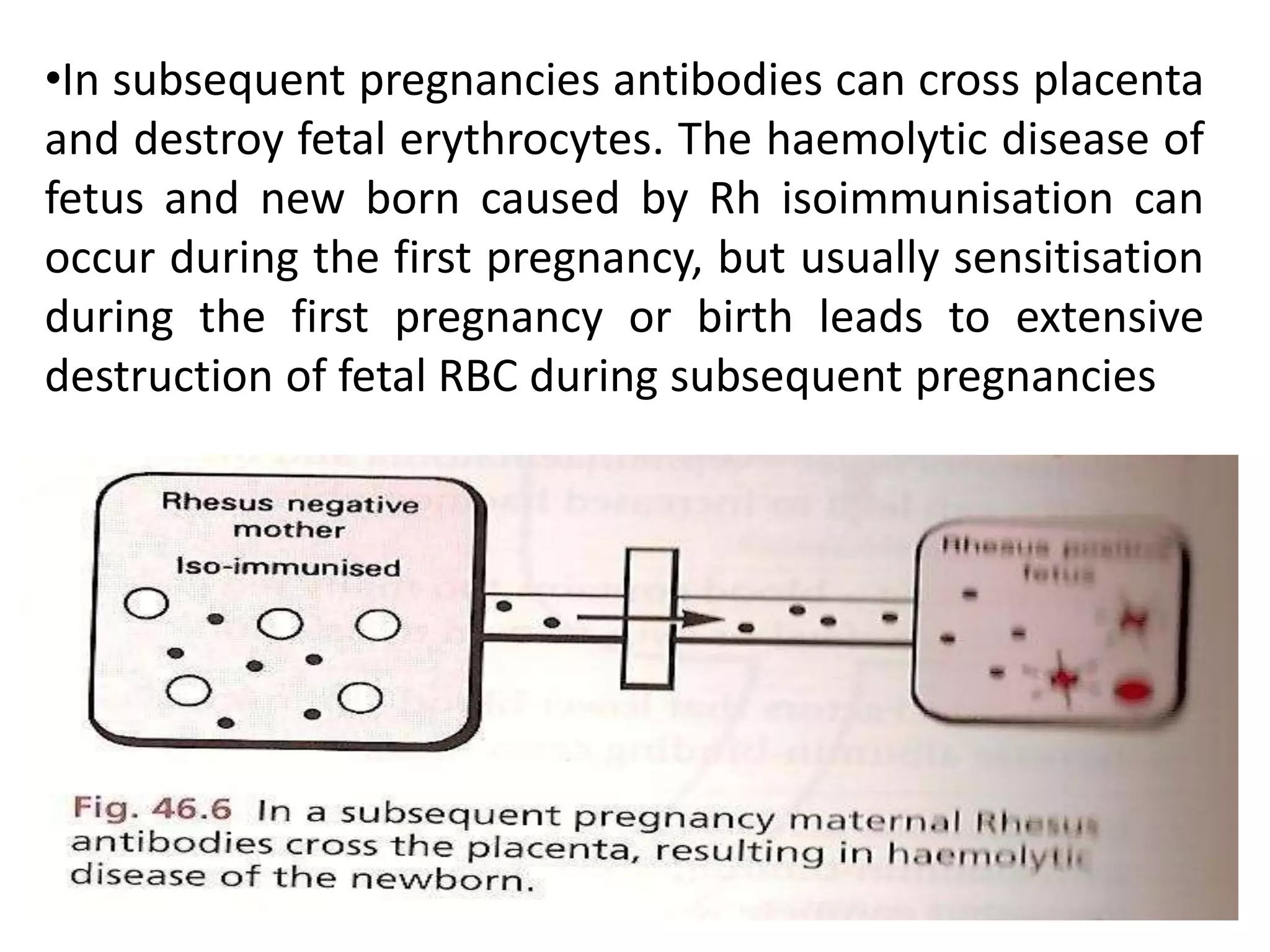 Iso immune disease | PPTX