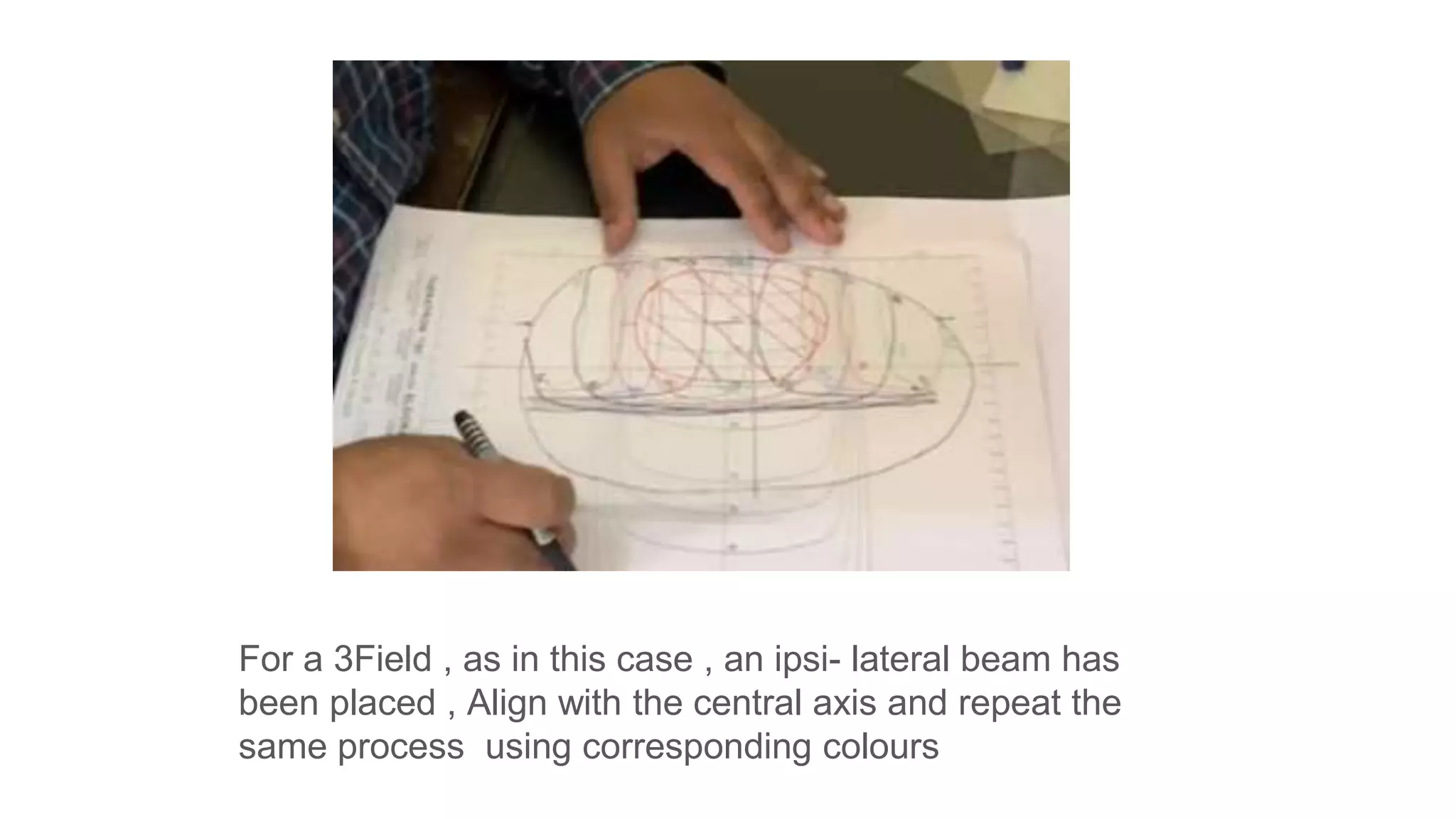 Manual Isodose Plotting | PPTX
