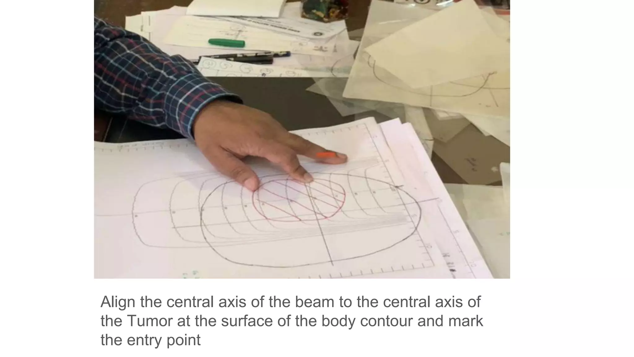 Manual Isodose Plotting | PPTX