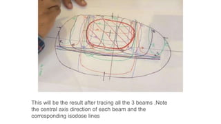 Manual Isodose Plotting | PPTX