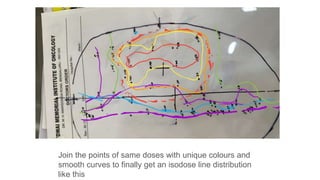 Manual Isodose Plotting | PPTX
