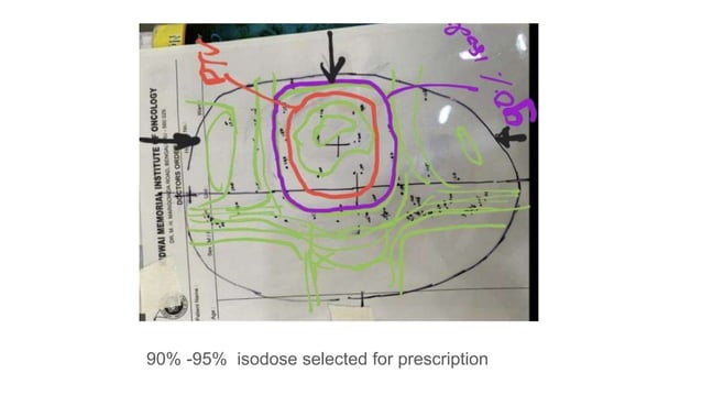 Manual Isodose Plotting | PPTX