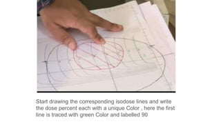 Manual Isodose Plotting | PPTX