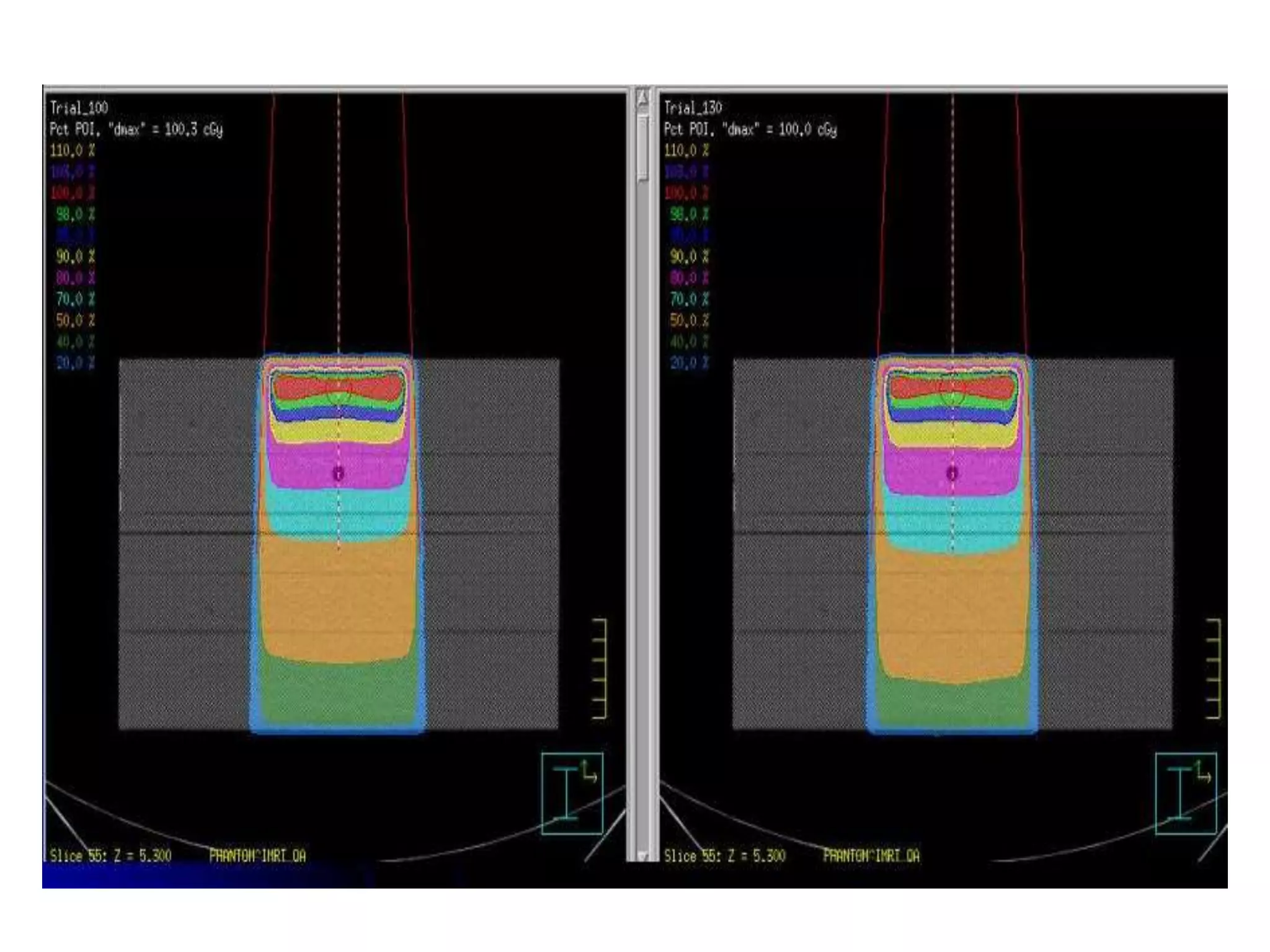 Isodose curves RADIATION ONCOLOGY | PPTX | Physics | Science
