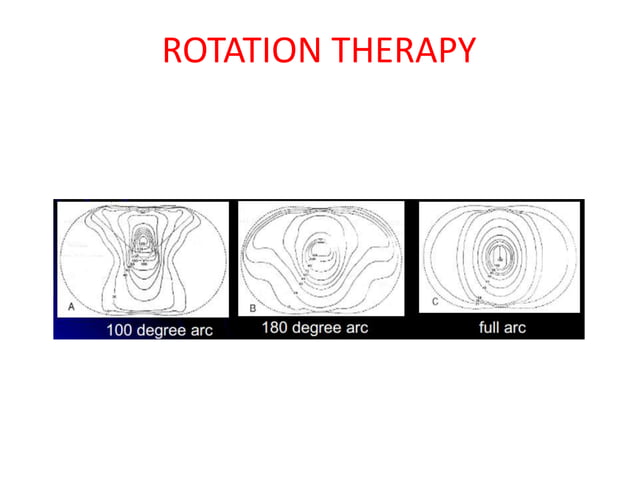 Isodose curves RADIATION ONCOLOGY | PPTX | Physics | Science