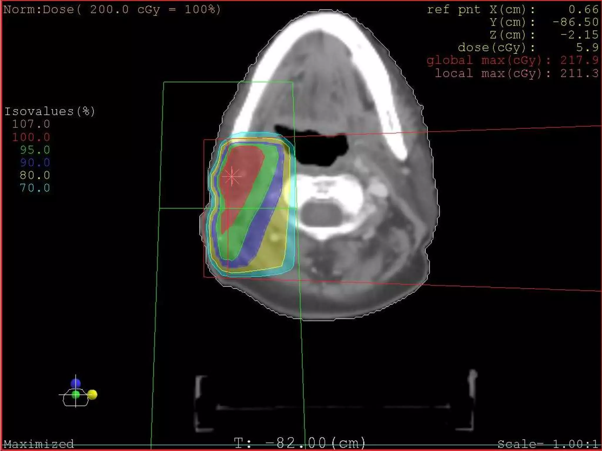 Isodose lines | PPTX