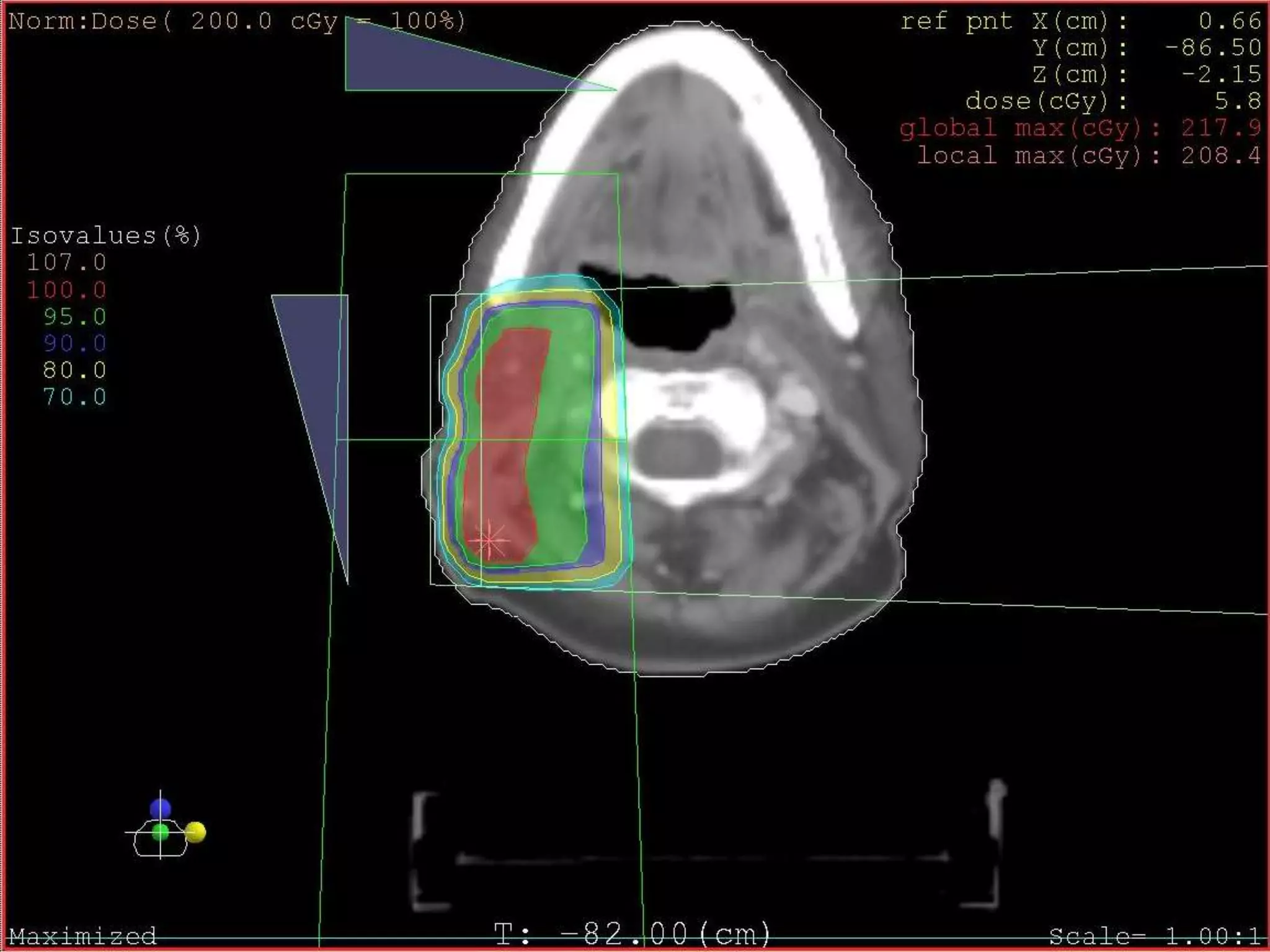 Isodose lines | PPTX
