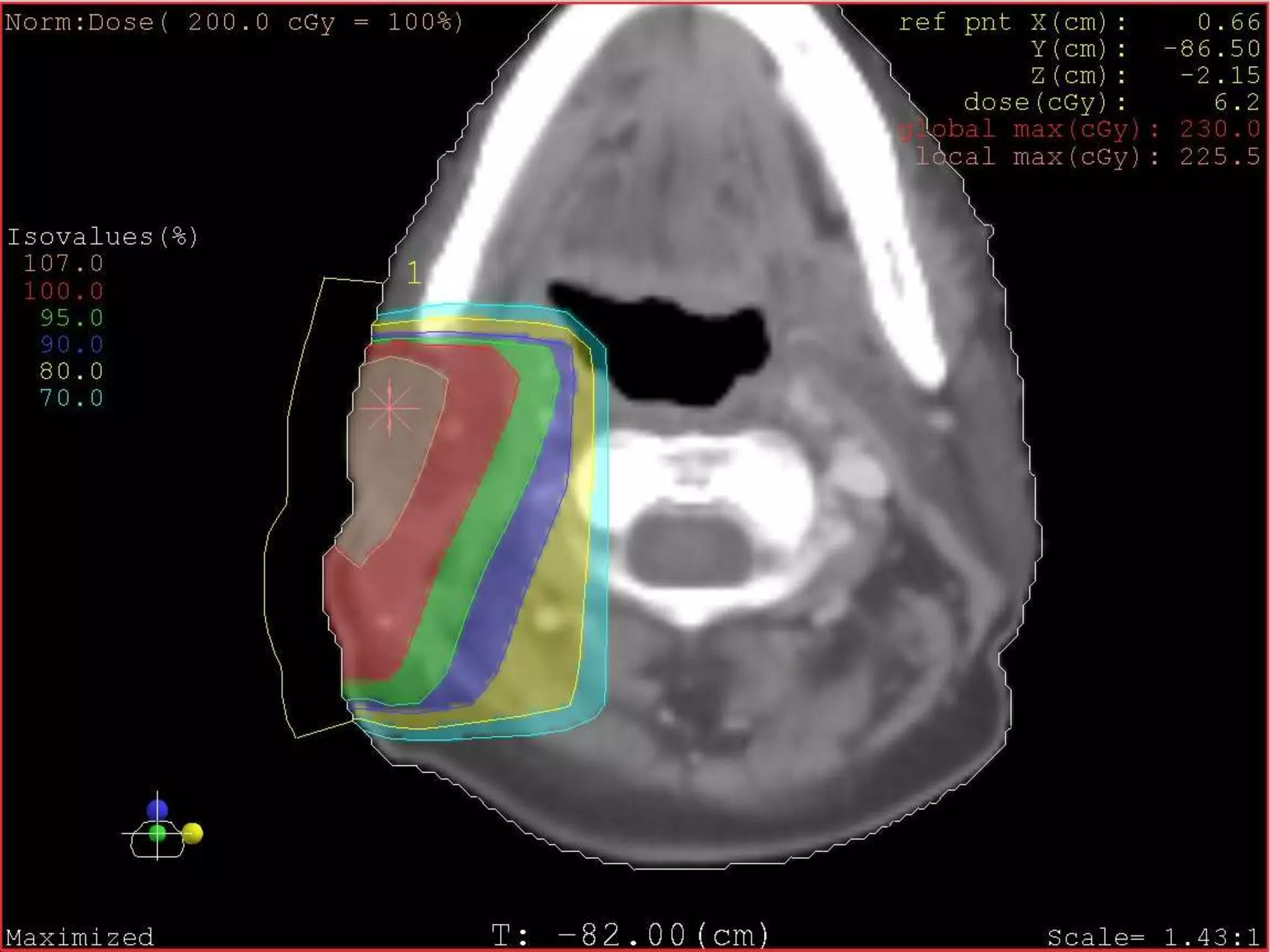 Isodose lines | PPTX