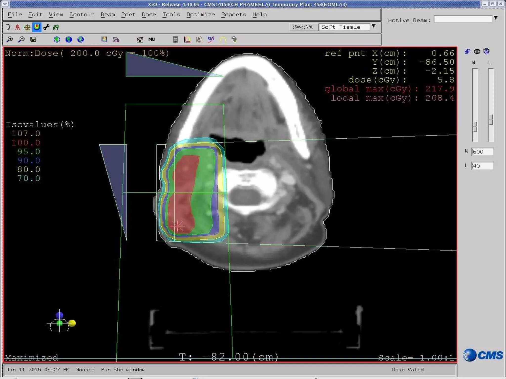 Isodose lines | PPTX