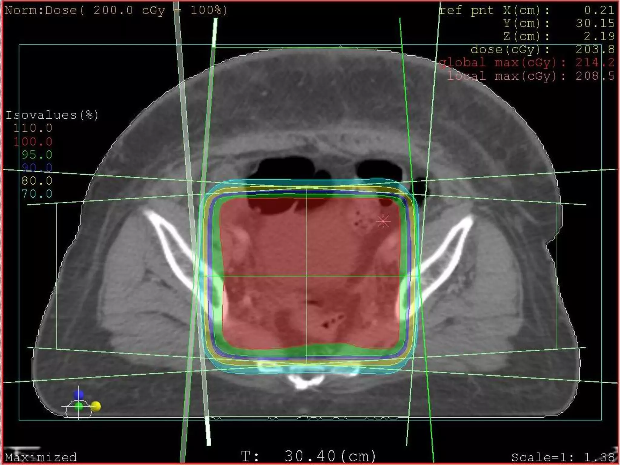 Isodose lines | PPTX