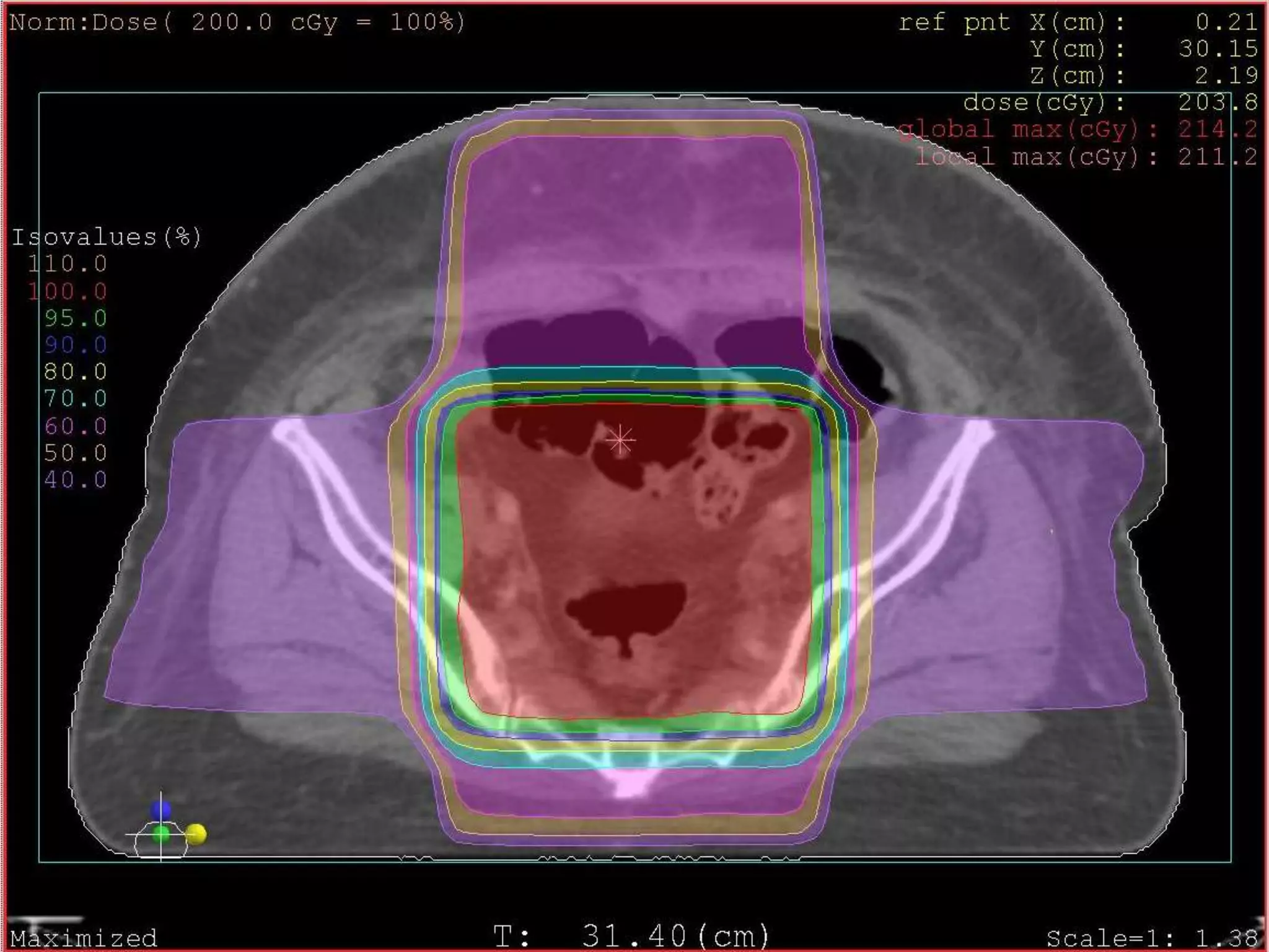 Isodose lines | PPTX