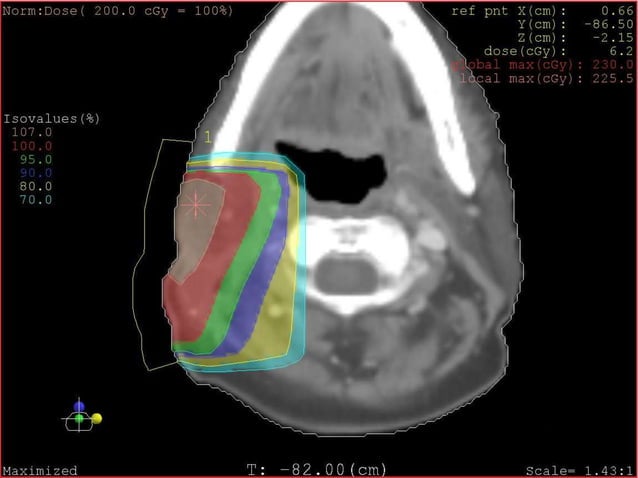 Isodose lines | PPTX