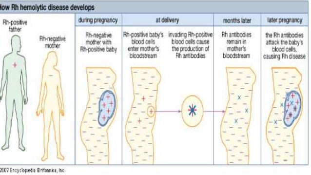 Isoimmunization | PPTX