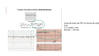 Isoinmunizacion materno fetal | PPTX