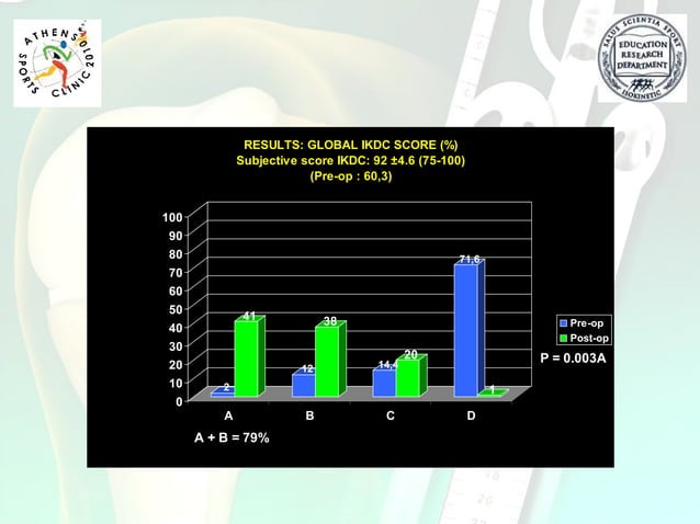 ACL Reconstruction using JewelAcl graft | PPT | Death, Injury, or ...
