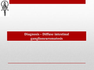 Isolated intestinal ganglioneuromatosis | PPTX | Digestive Disorders ...