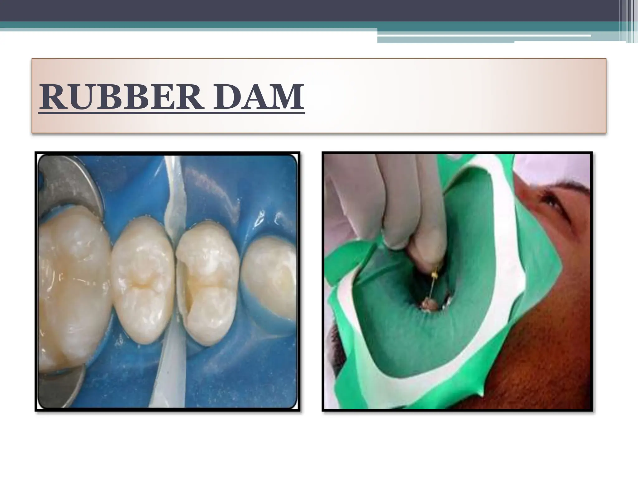 isolation types, advantages and disadvantages | PPT