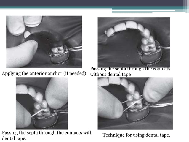 Isolation Types Advantages And Disadvantages Ppt