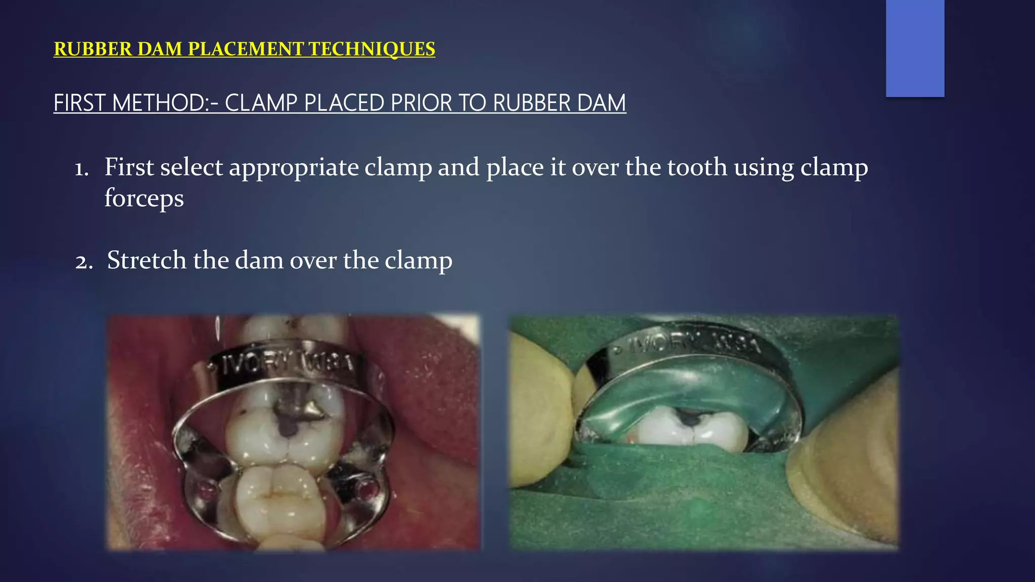 Isolation in restorative dentistry | PPTX