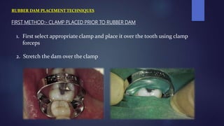 Isolation in restorative dentistry | PPTX