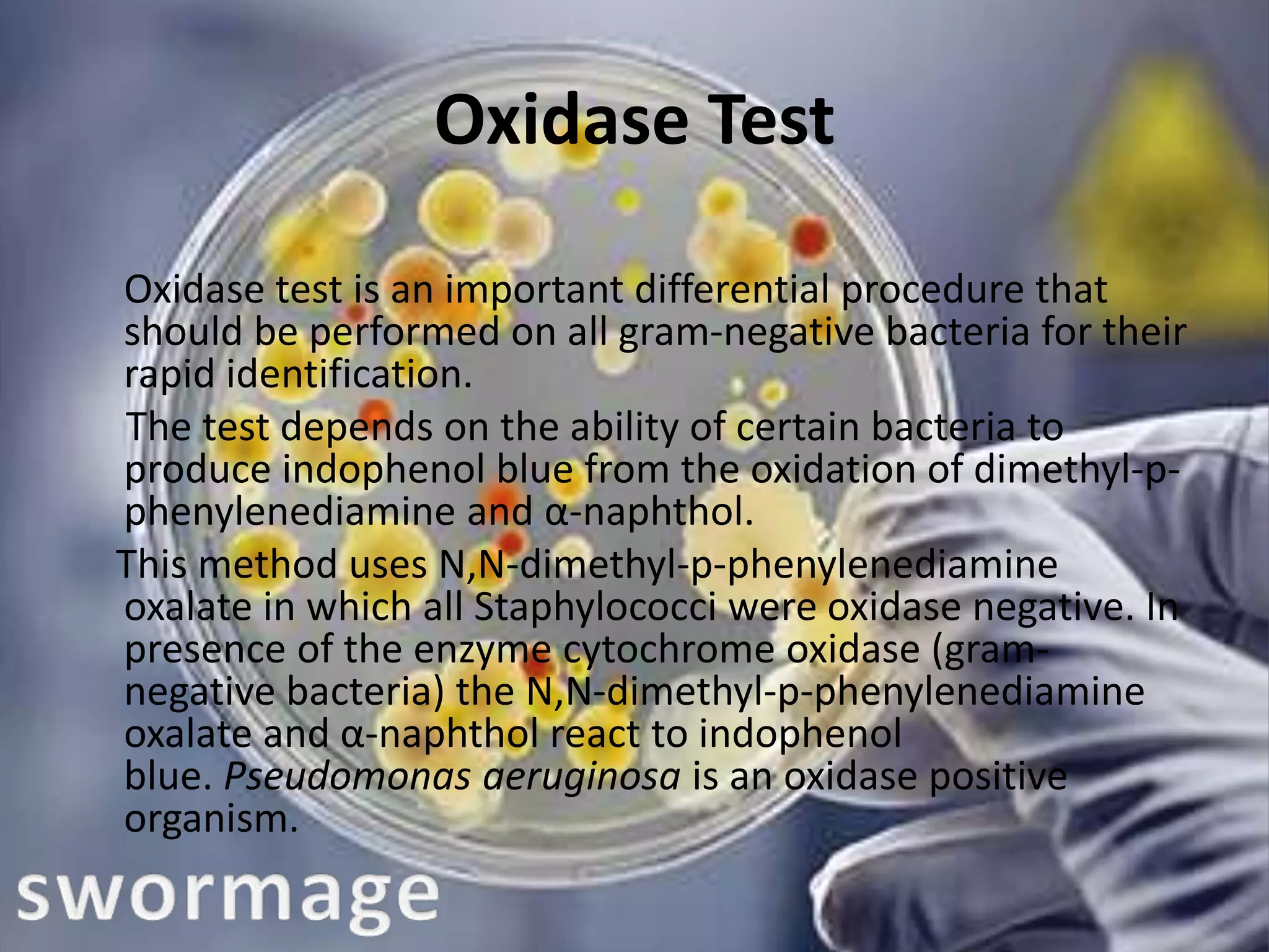 Isolation and identification of bacteria by sworna | PPTX