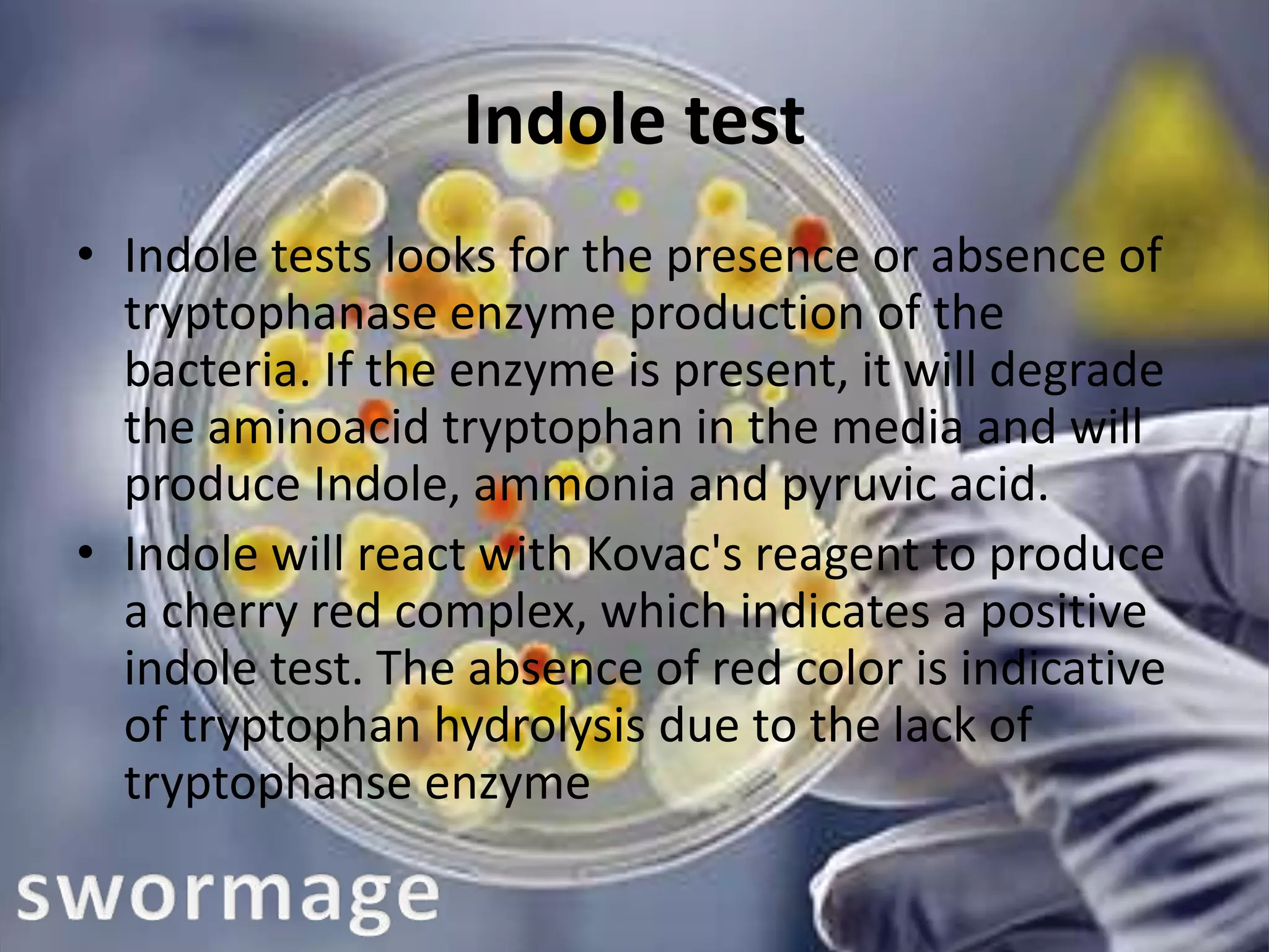 Isolation and identification of bacteria by sworna | PPTX