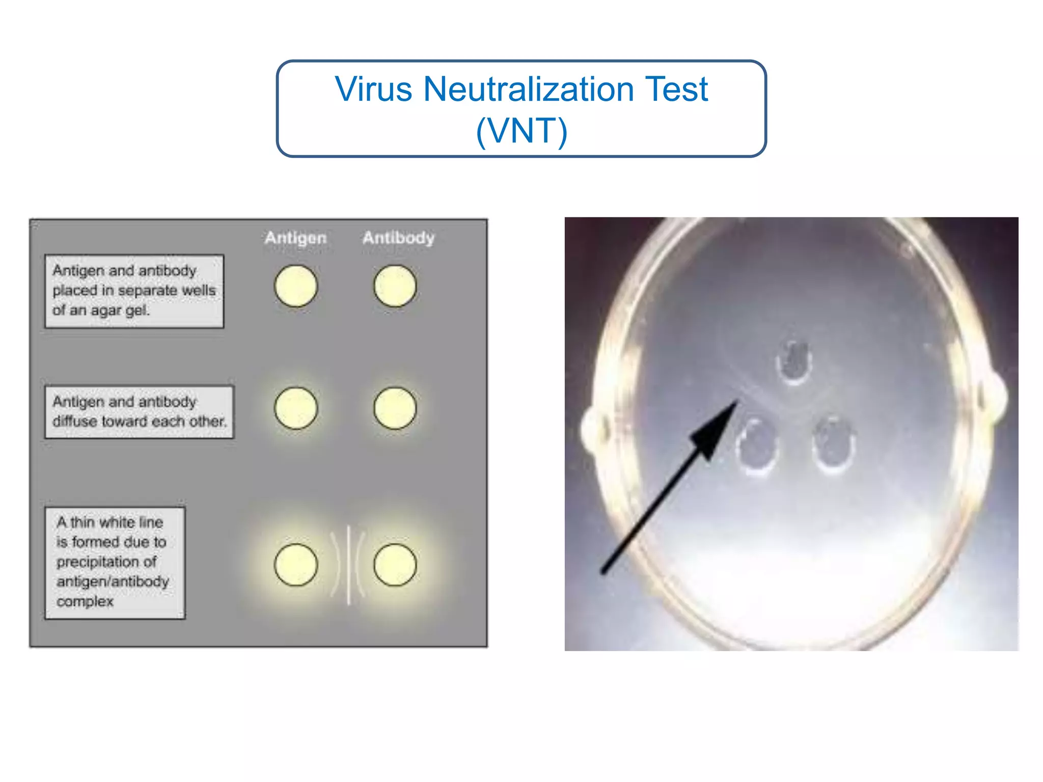 Isolation and identification of infectious bursal disease virus | PPTX