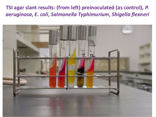 Isolation and identification of salmonella &e.coli