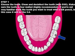 Isolation and Matrices.pptx