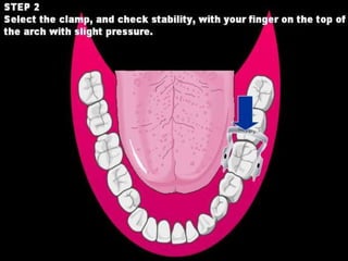 Isolation and Matrices.pptx