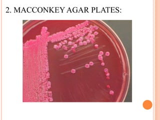Isolation & identification of staphylococcus auerus | PPTX