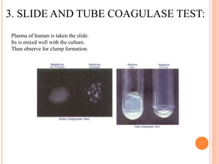 Isolation & identification of staphylococcus auerus | PPTX
