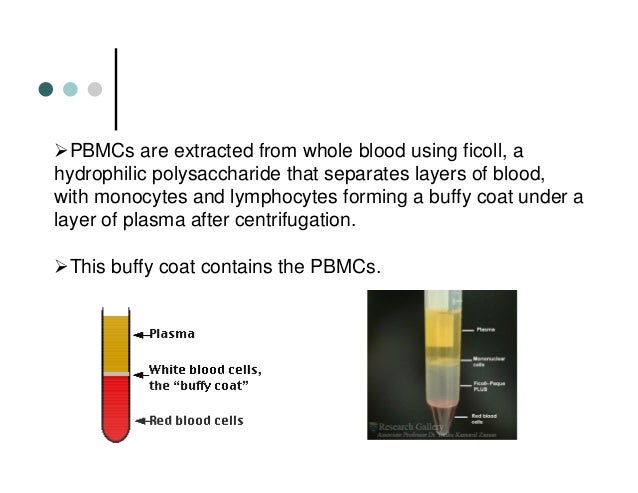 Isolation of pbmc