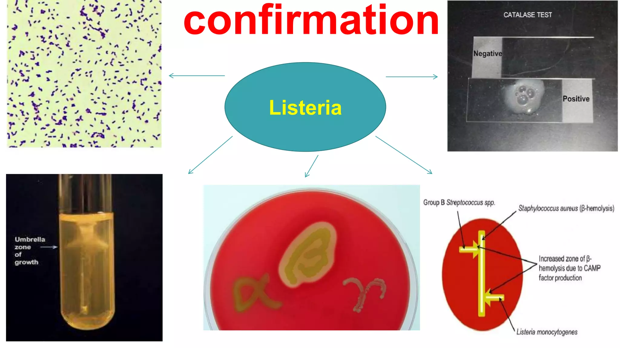 Isolation of some pathogens from milk | PPT