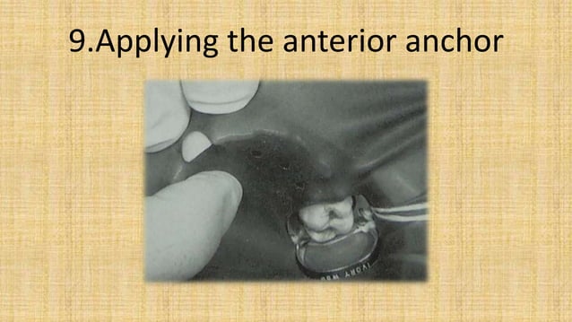 Isolation of the operative & endodontic field | PPTX | Dental Health ...