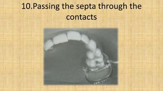 Isolation of the operative & endodontic field | PPTX
