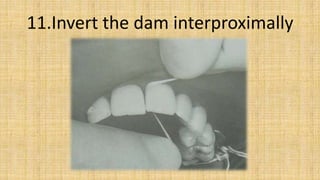 Isolation of the operative & endodontic field | PPTX