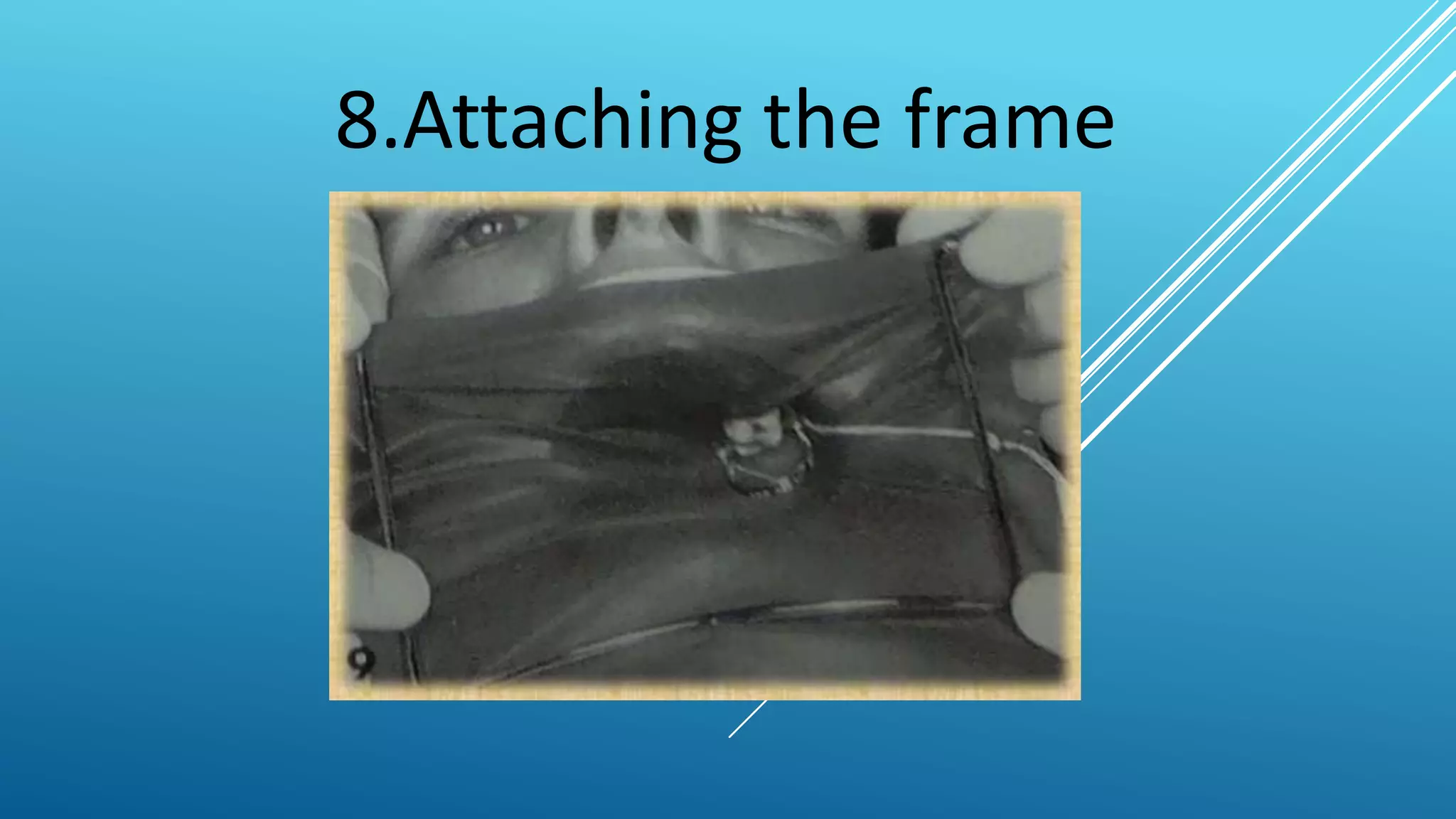 Isolation of the operative field | PPTX