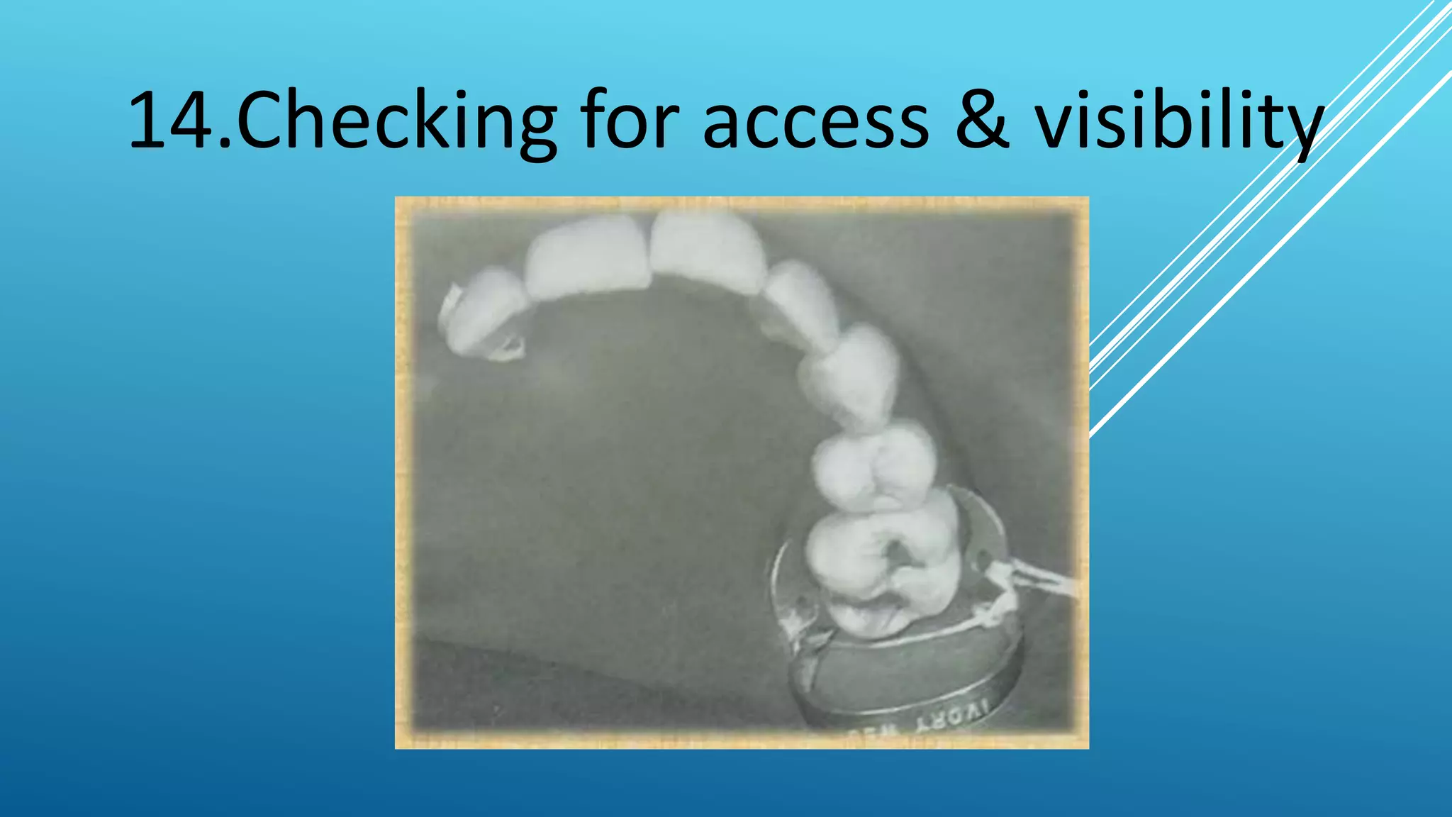 Isolation of the operative field | PPTX