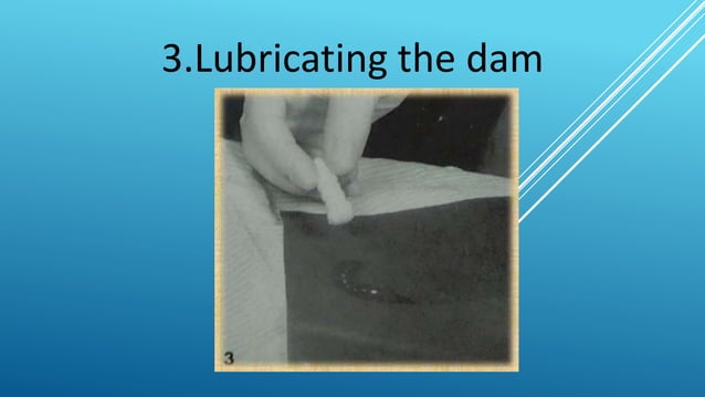 Isolation of the operative field | PPTX | Dental Health | Diseases and ...
