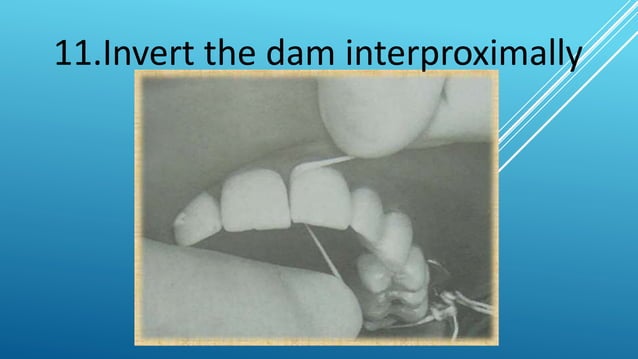 Isolation of the operative field | PPTX | Dental Health | Diseases and ...