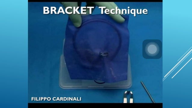 Isolation of the operative field | PPTX | Dental Health | Diseases and ...