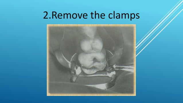 Isolation of the operative field | PPTX | Dental Health | Diseases and ...