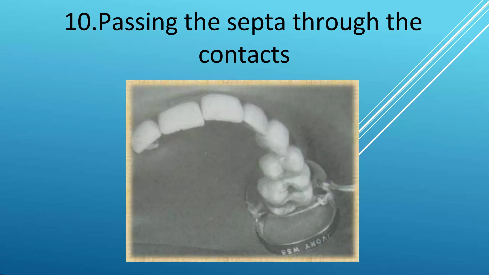 isolationoftheoperative.pptx