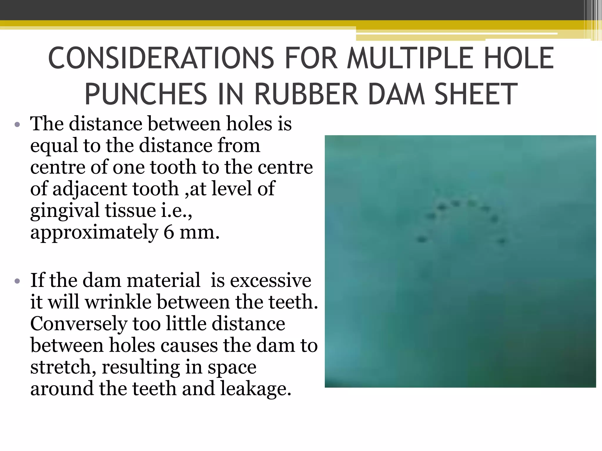 Isolation: The Rubber Dam | PPTX