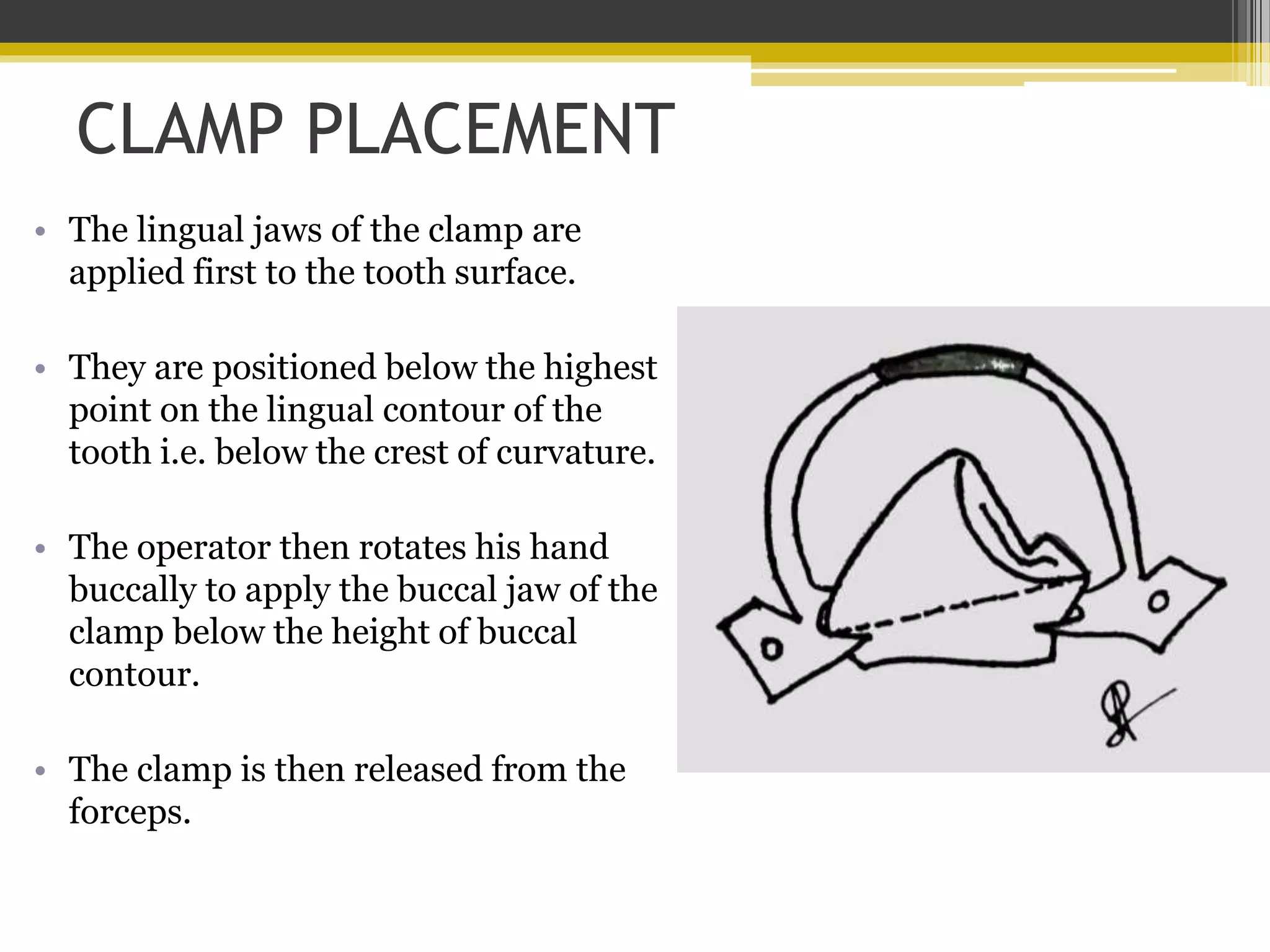 Isolation: The Rubber Dam | PPTX